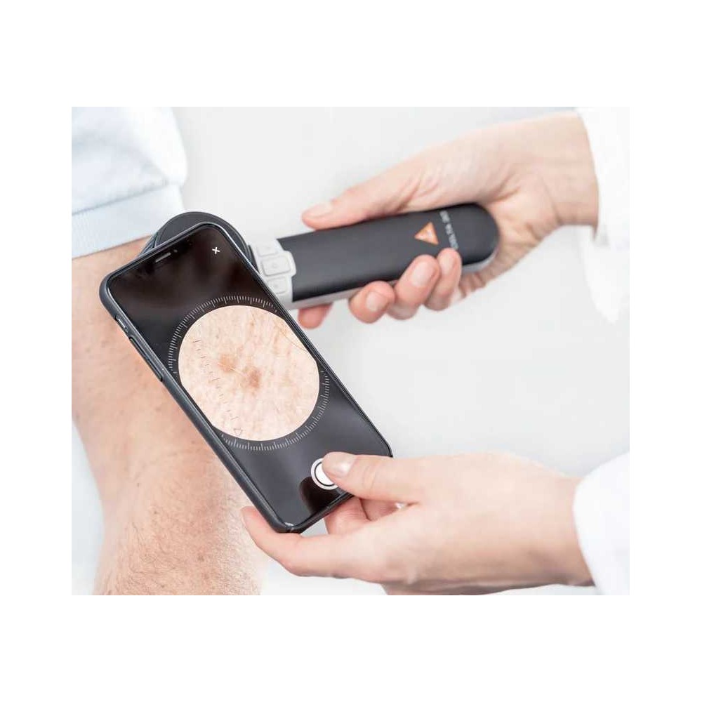 HEINE DELTA 30 Dermatoscope Set
